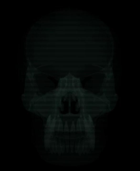 Alexander Thapar - CT Skull Scan Animation