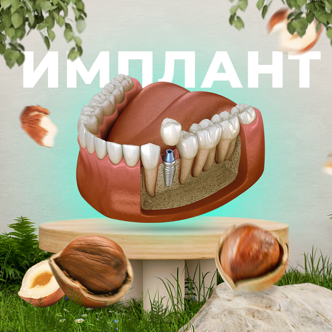 ArtStation - YANCreatives-Sinerg*