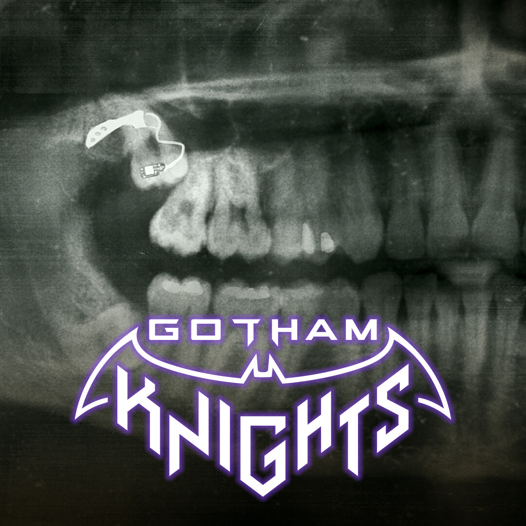 ArtStation - X-rays props