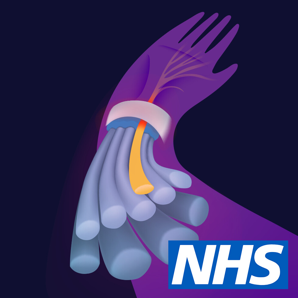 ArtStation - Carpal Tunnel Syndrome Leaflet