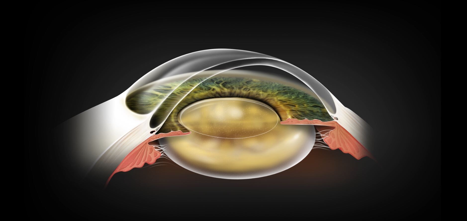 ArtStation - Eye Medical Animation