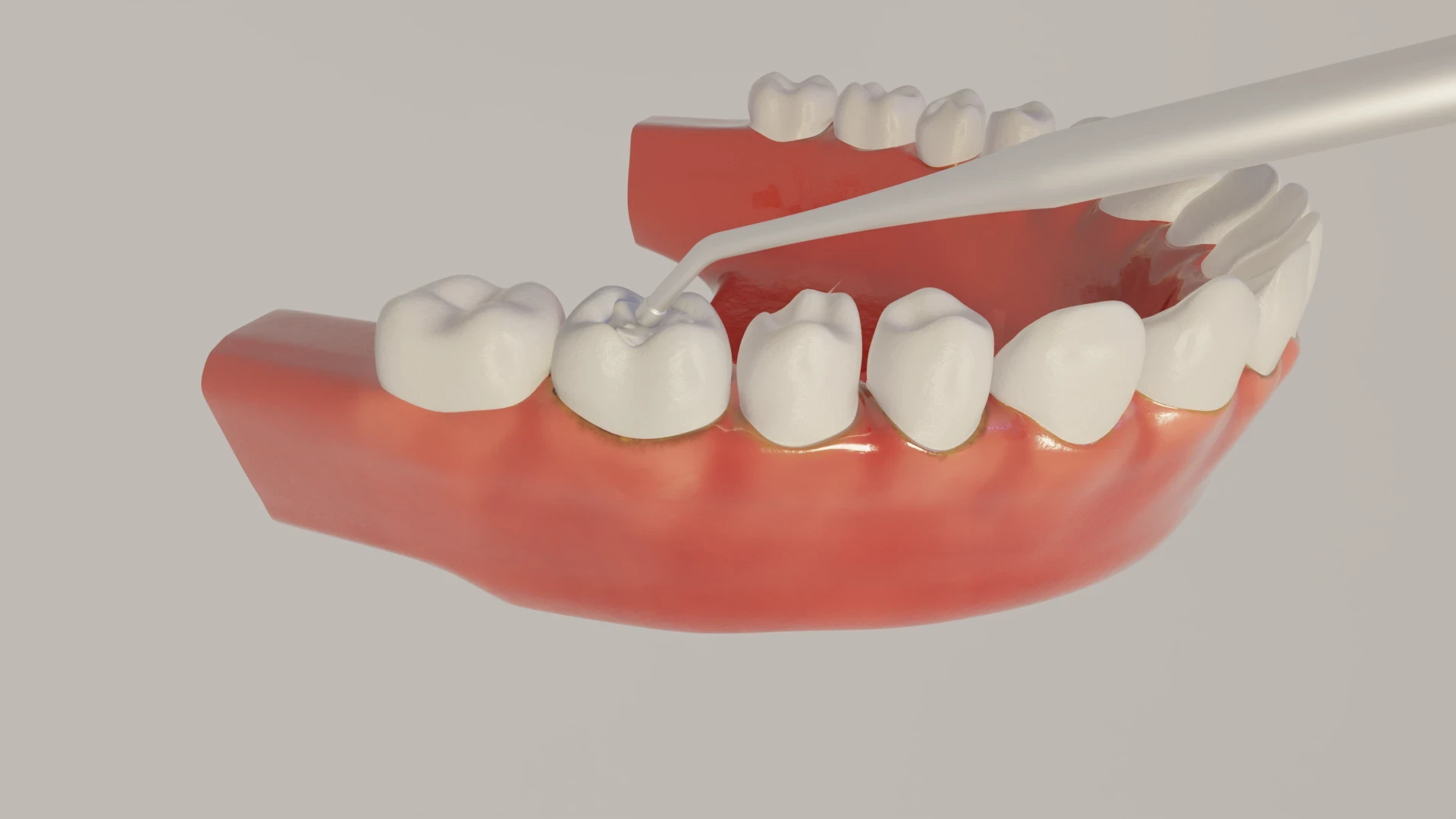 ArtStation - Dental Procedure Animation