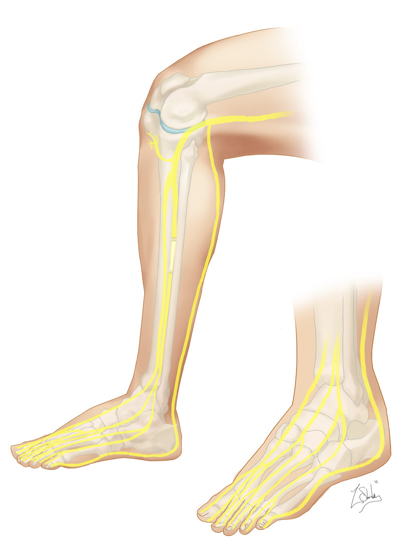 ArtStation - Branches of the Peroneal Nerve and Dorsal Nerves of the Foot