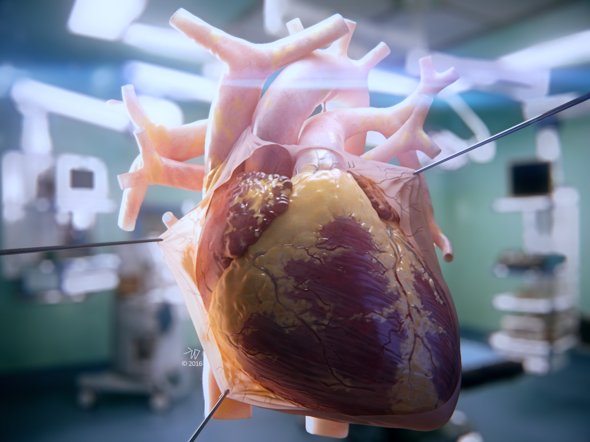 ArtStation - Cardiac Anatomy