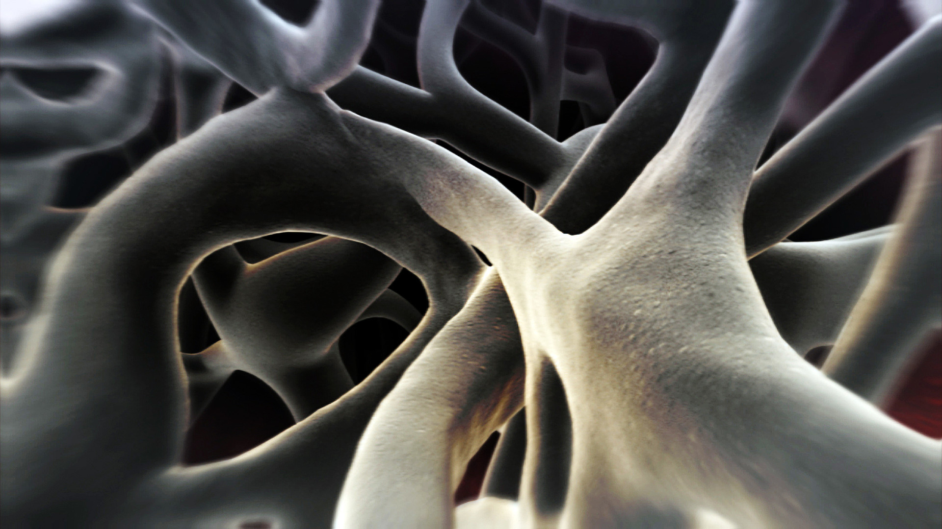 Simon Barrett - Bone Microstructure