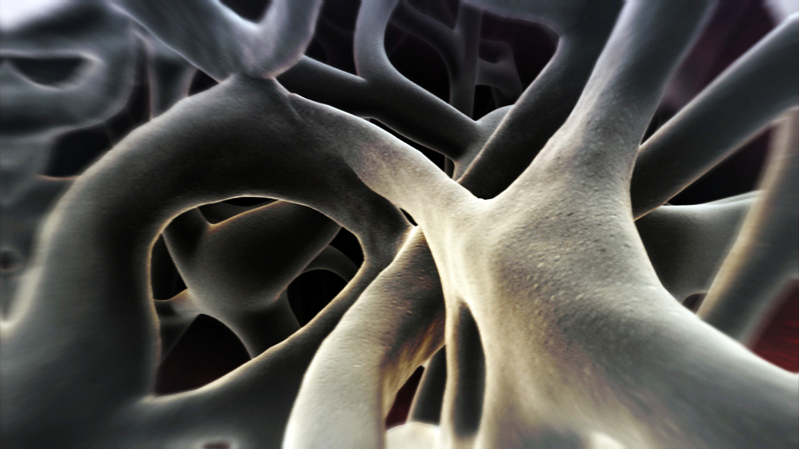 Simon Barrett - Bone Microstructure