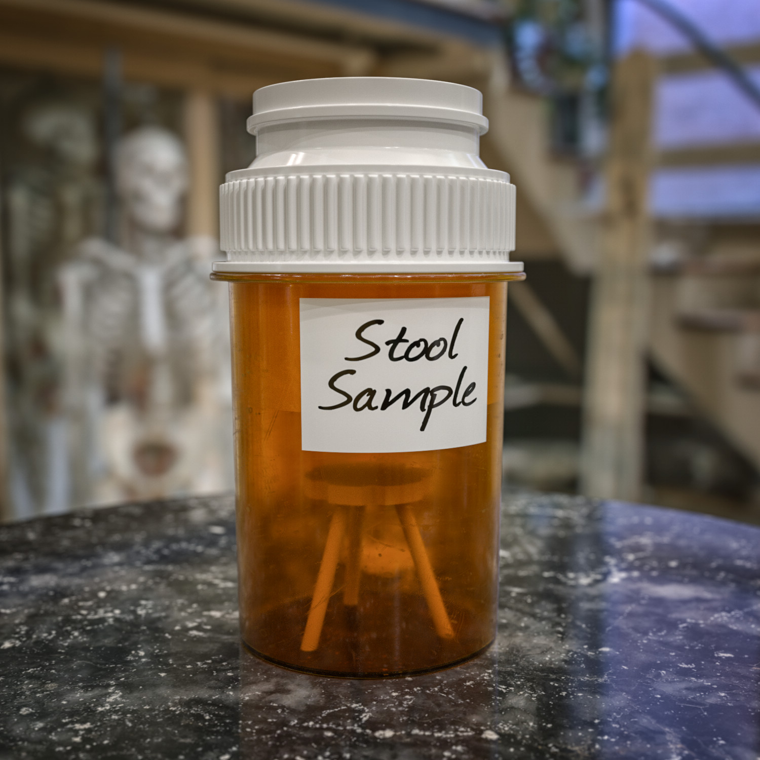 Niko Schatz - The little different stool sample