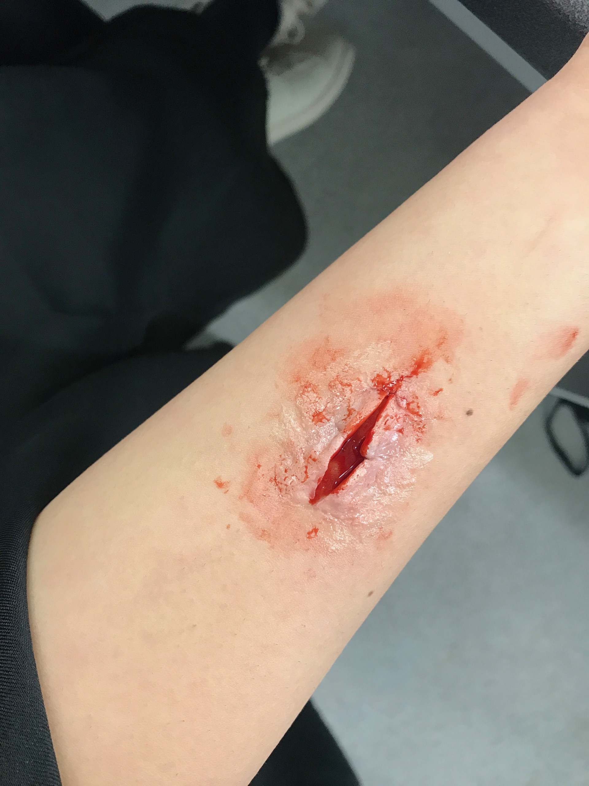 cut on arm small