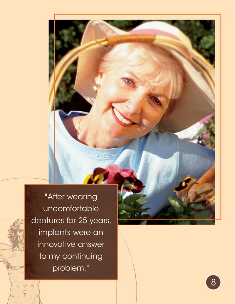 Charles Kent - Dr. Spera Implant Brochure