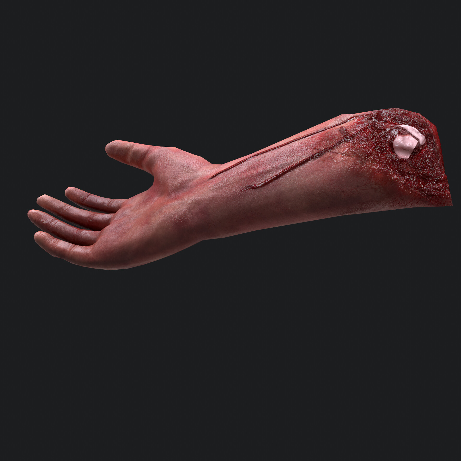 dismembered arm