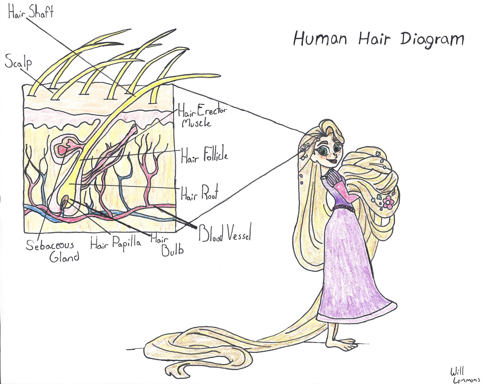 William Lemmons - Artwork upload