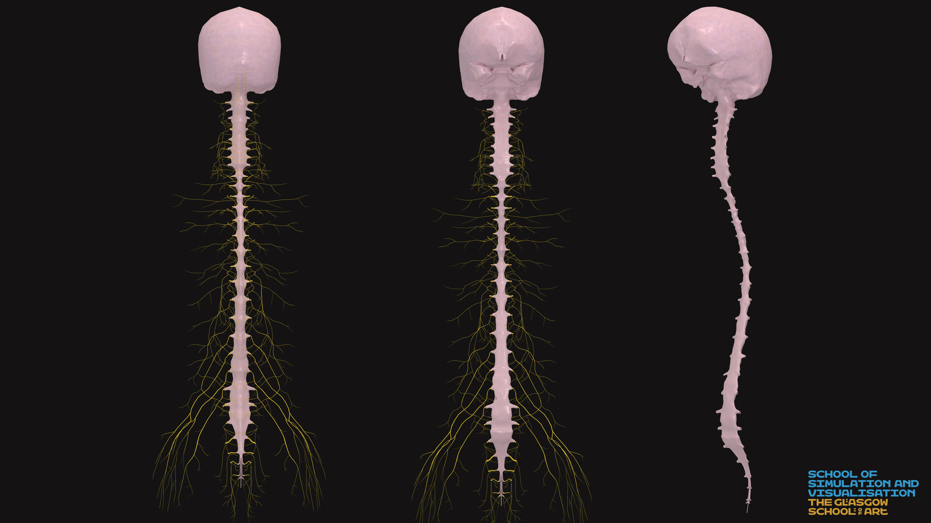 James Alexander Simpson - Dura and spinal nerves (Definative Human Project)