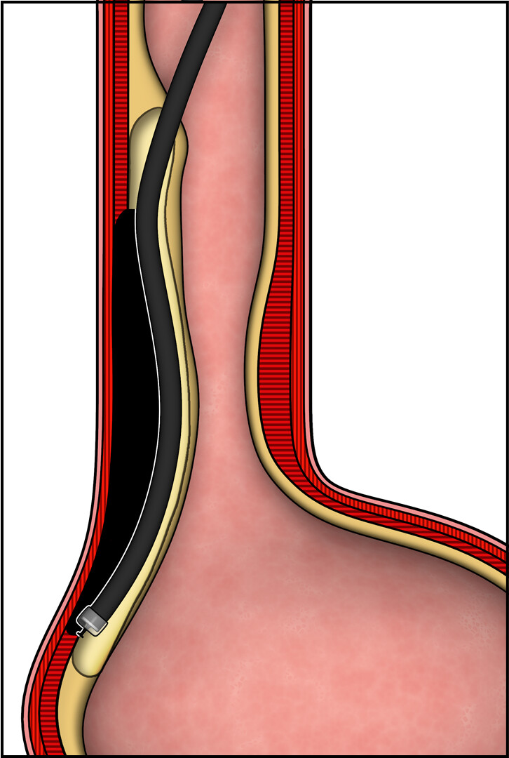 Donald Backos Artstation Portfolio - Surgery Diagrams