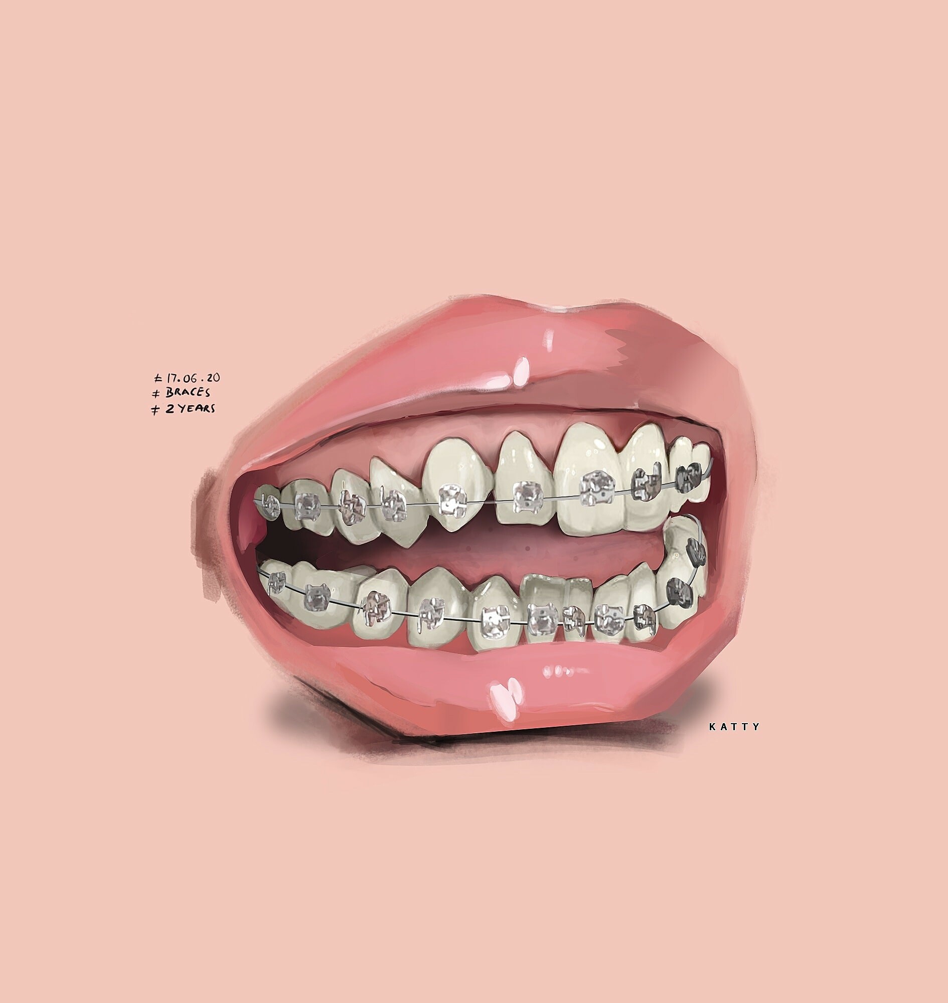 ArtStation - Braces