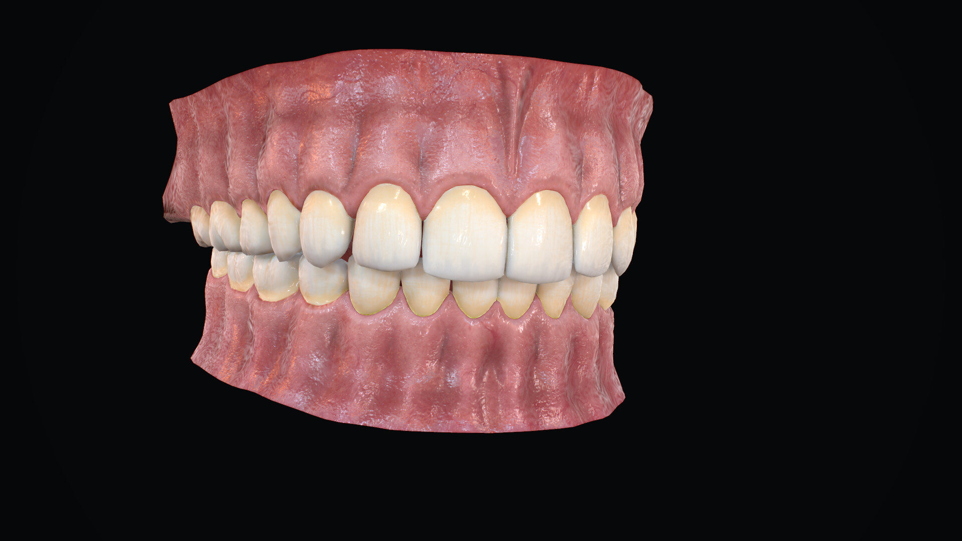 ArtStation - Realistic Teeth - Real-time for production