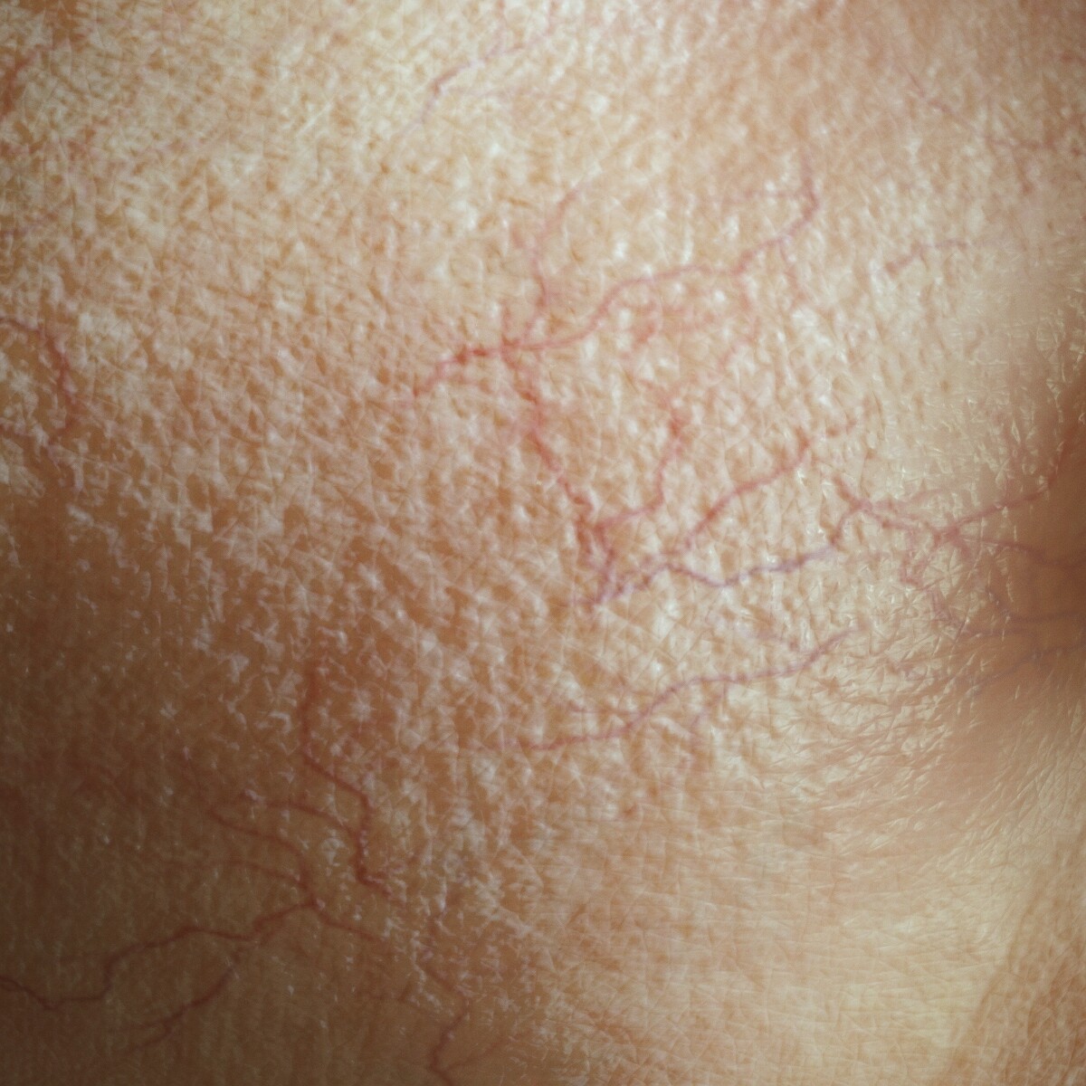 Reallusion Inc. - Realistic skin effect: Capillary
