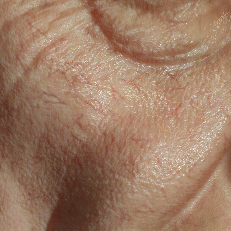 Reallusion Inc. - Realistic skin effect: Capillary