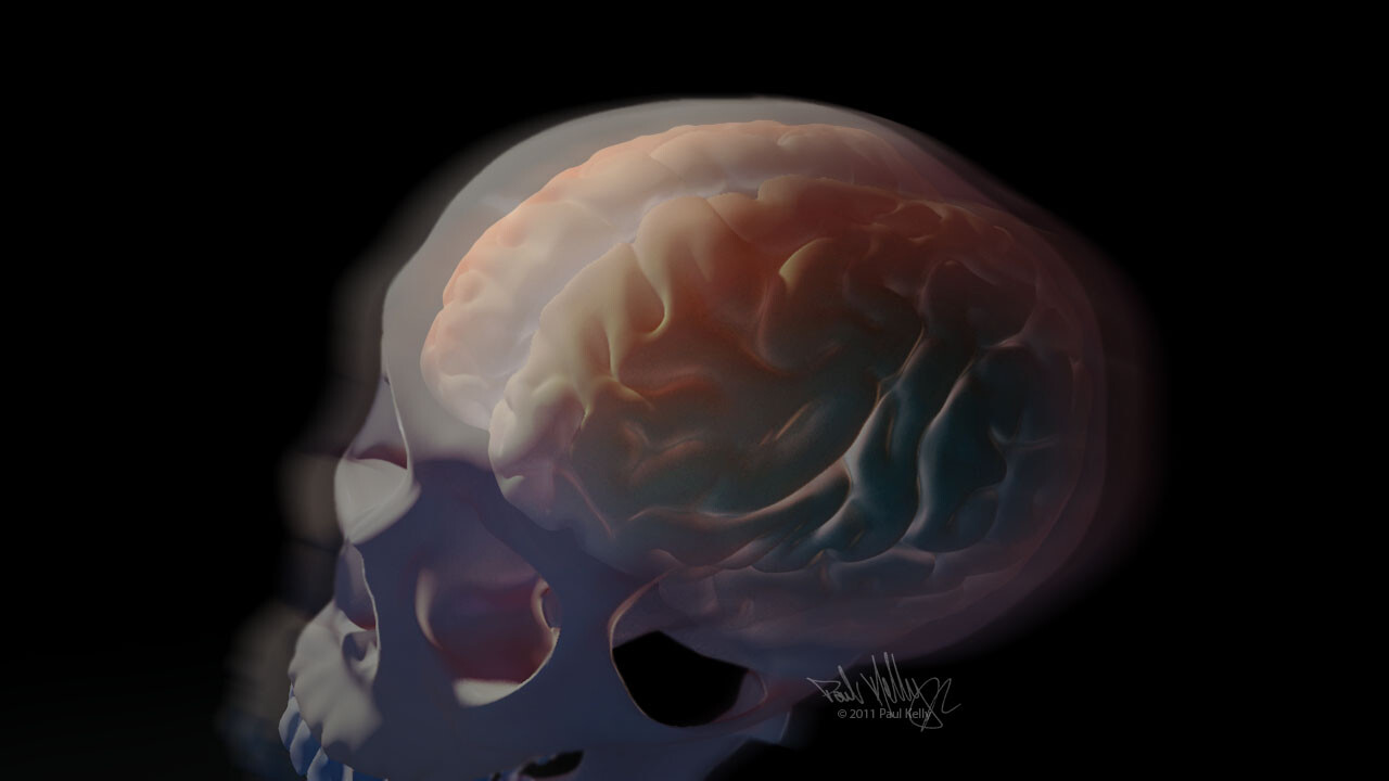ArtStation - Brain Injury