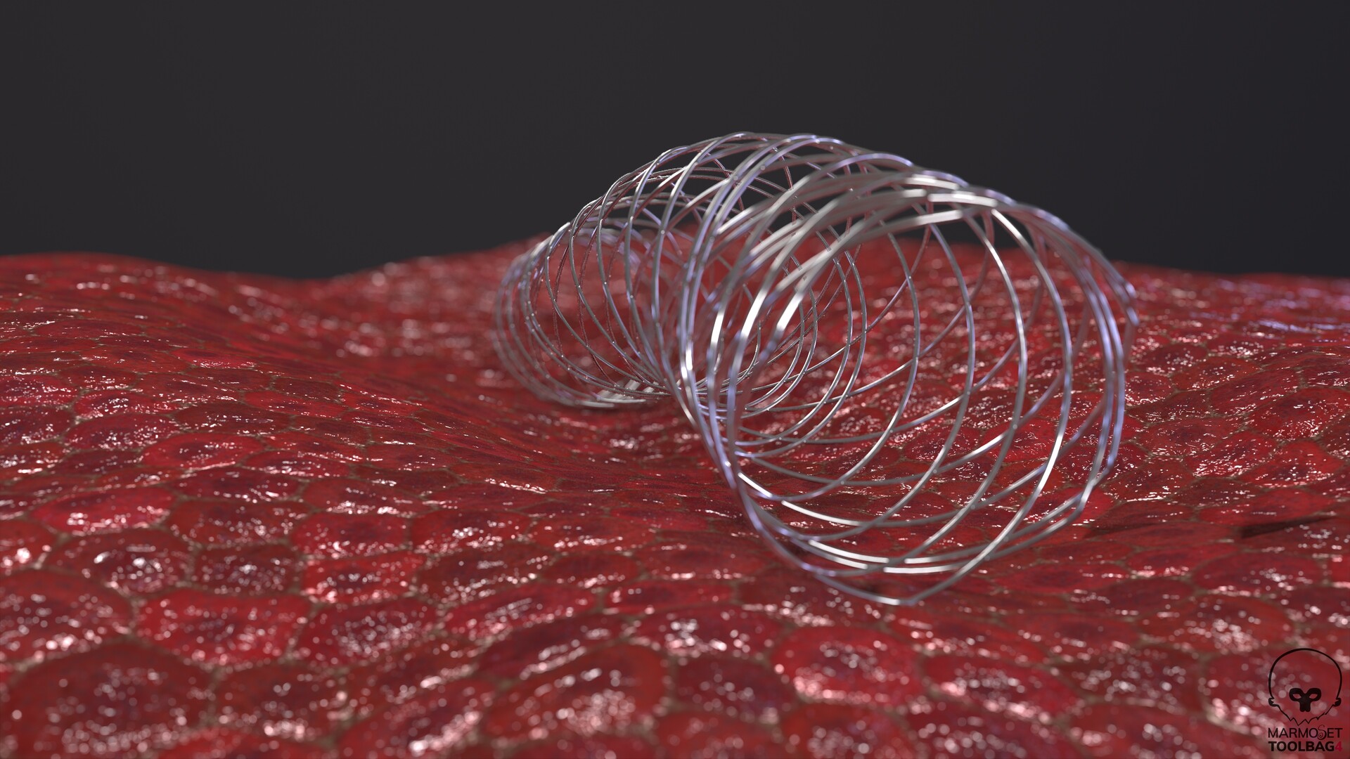 Yuriy Kulikov - Intravascular stent