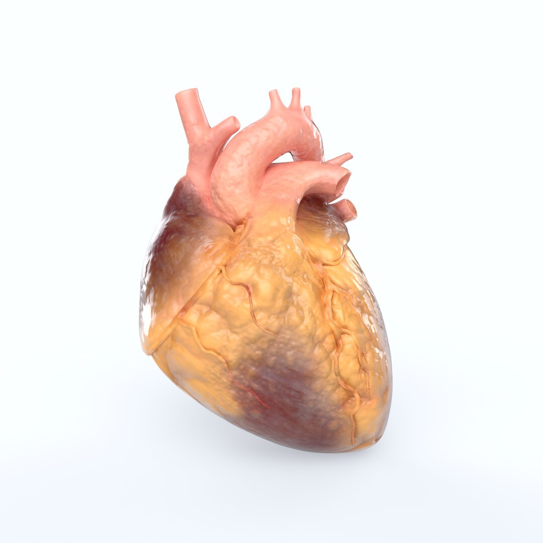 Arman Dalay - Healthy vs. fatty heart