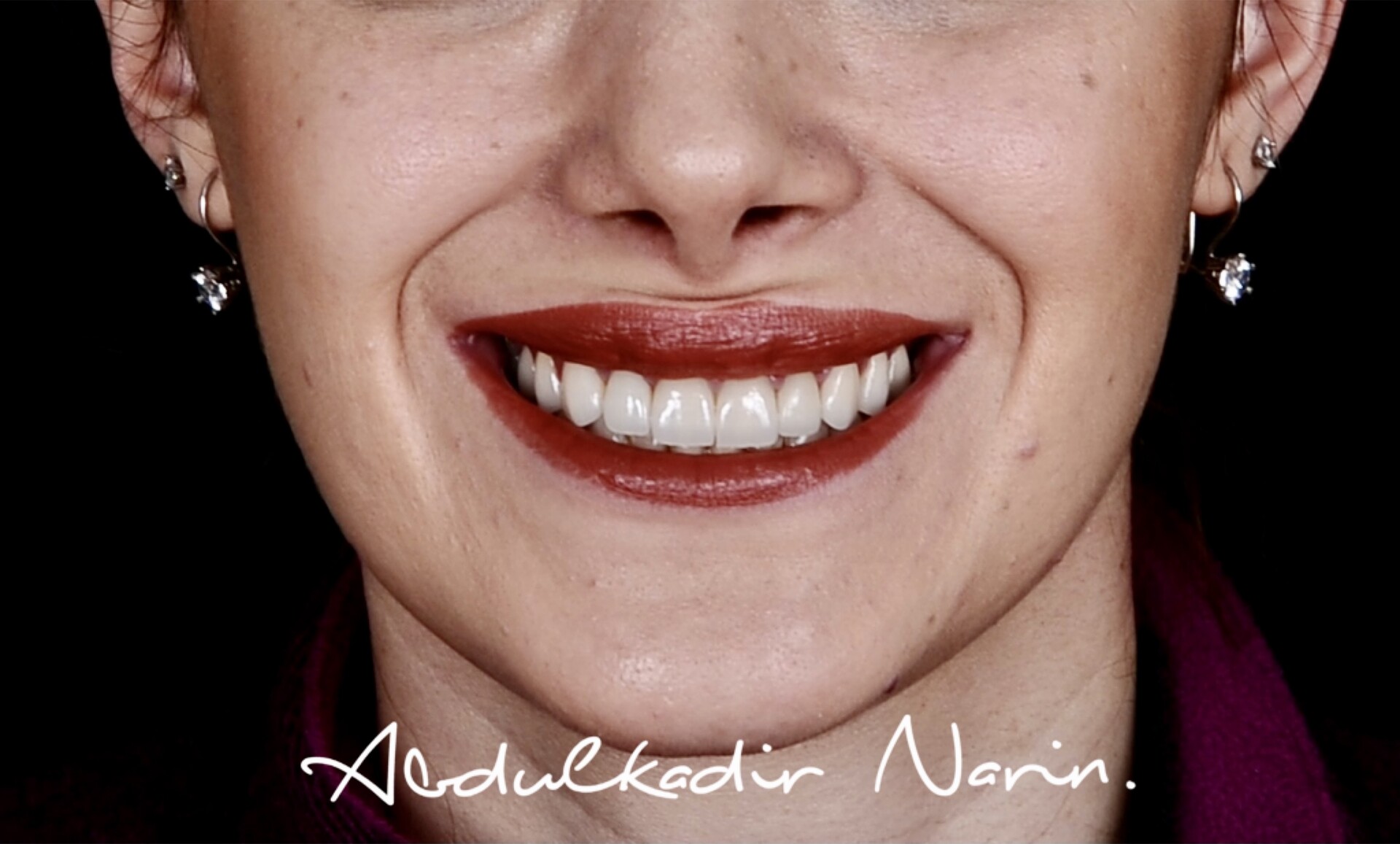 ArtStation - Smile Design Art