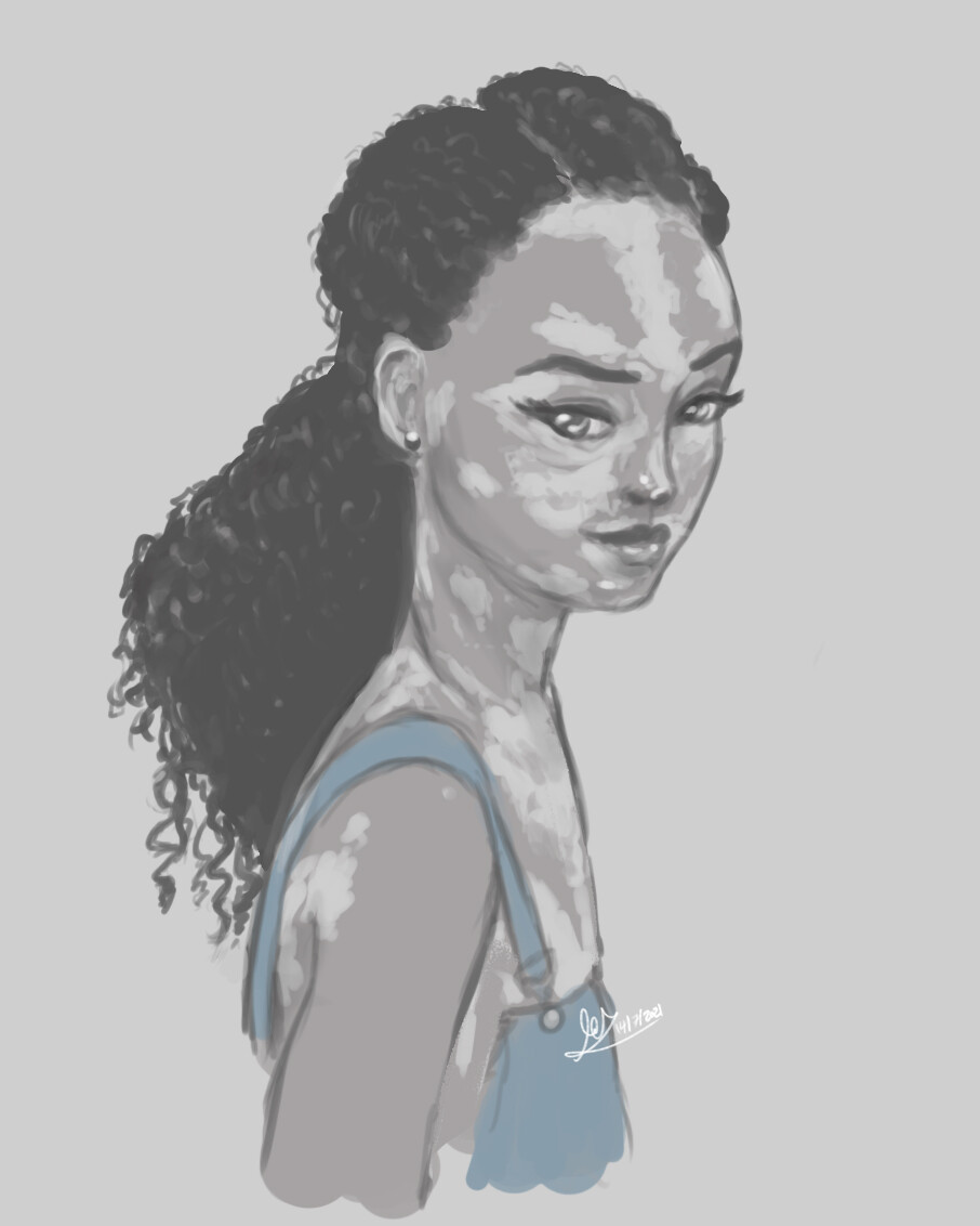 ArtStation - vitiligo character portrait