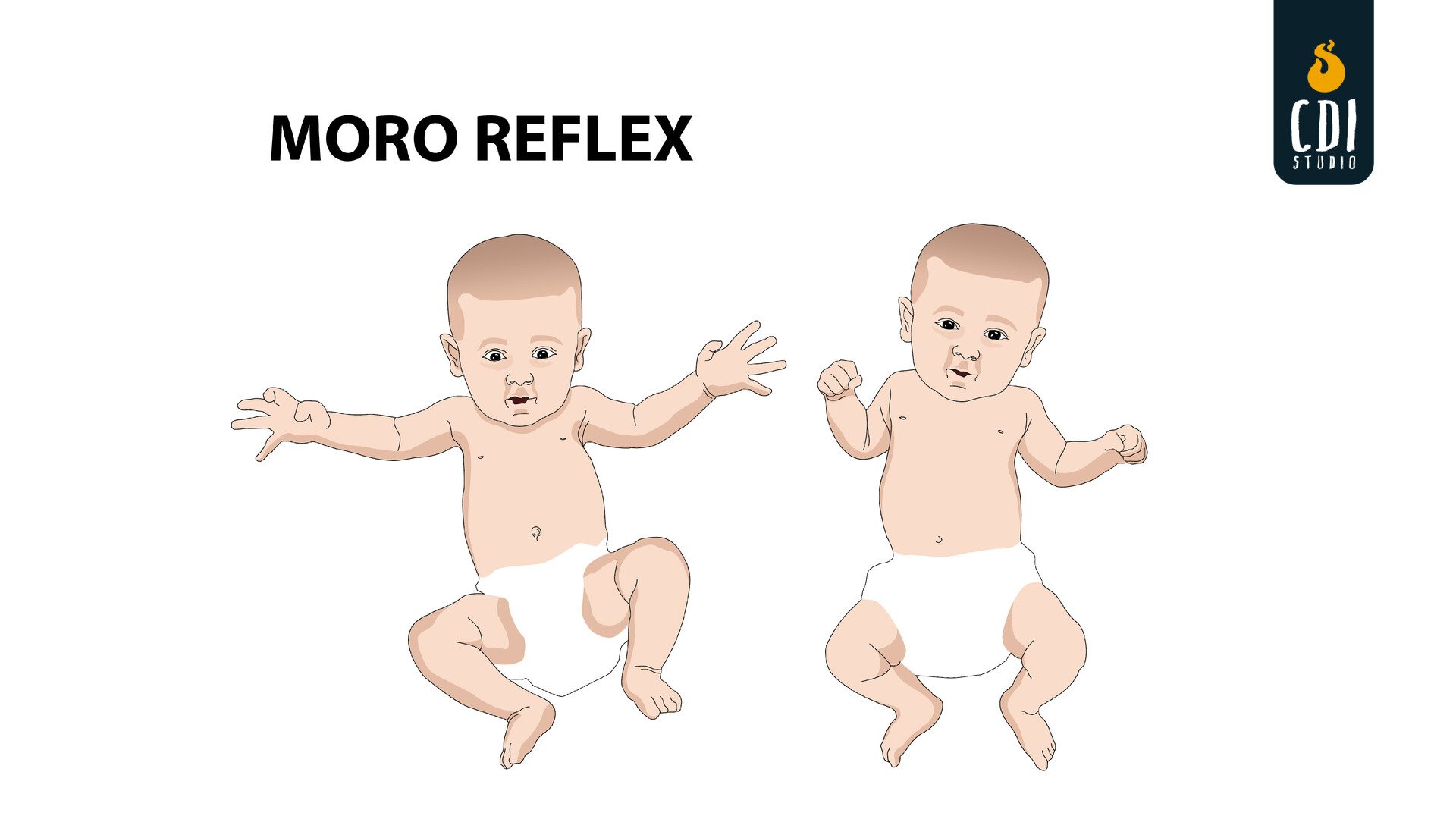 Cartoon Reflex Childern