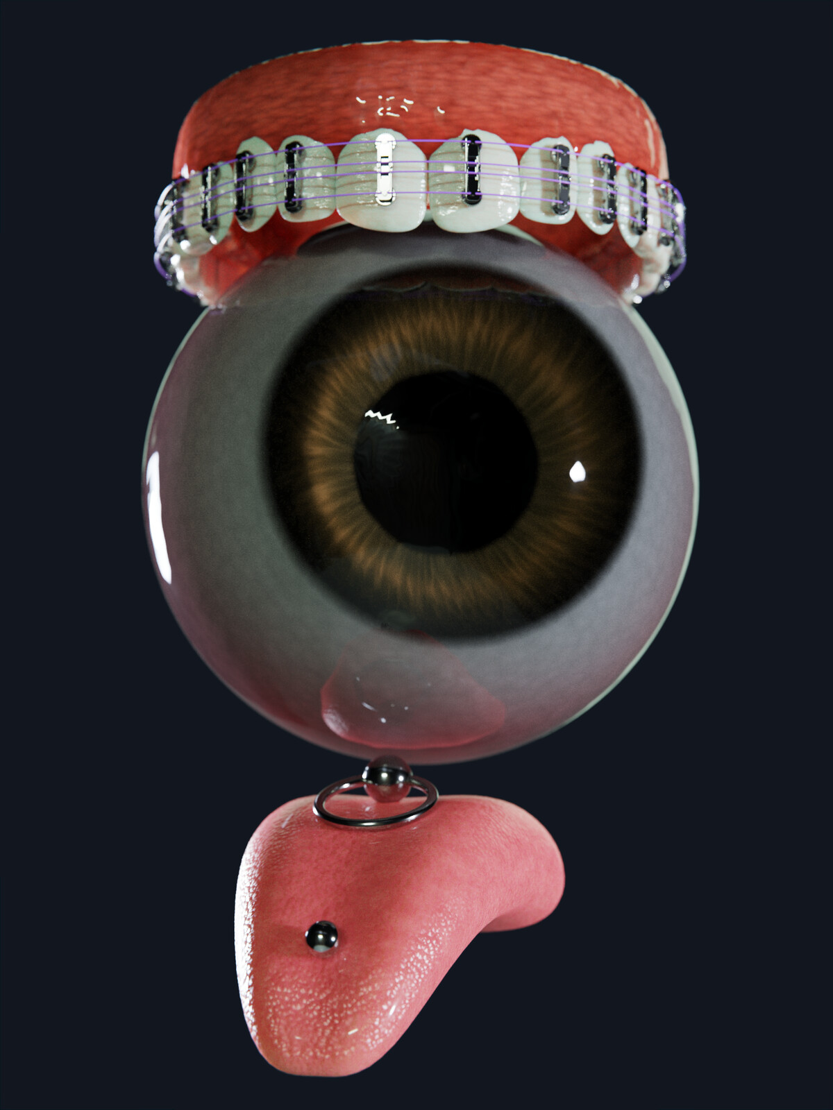 Randy Bruner - Braces