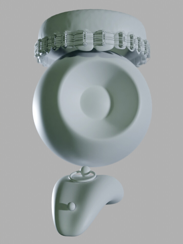 Randy Bruner - Braces