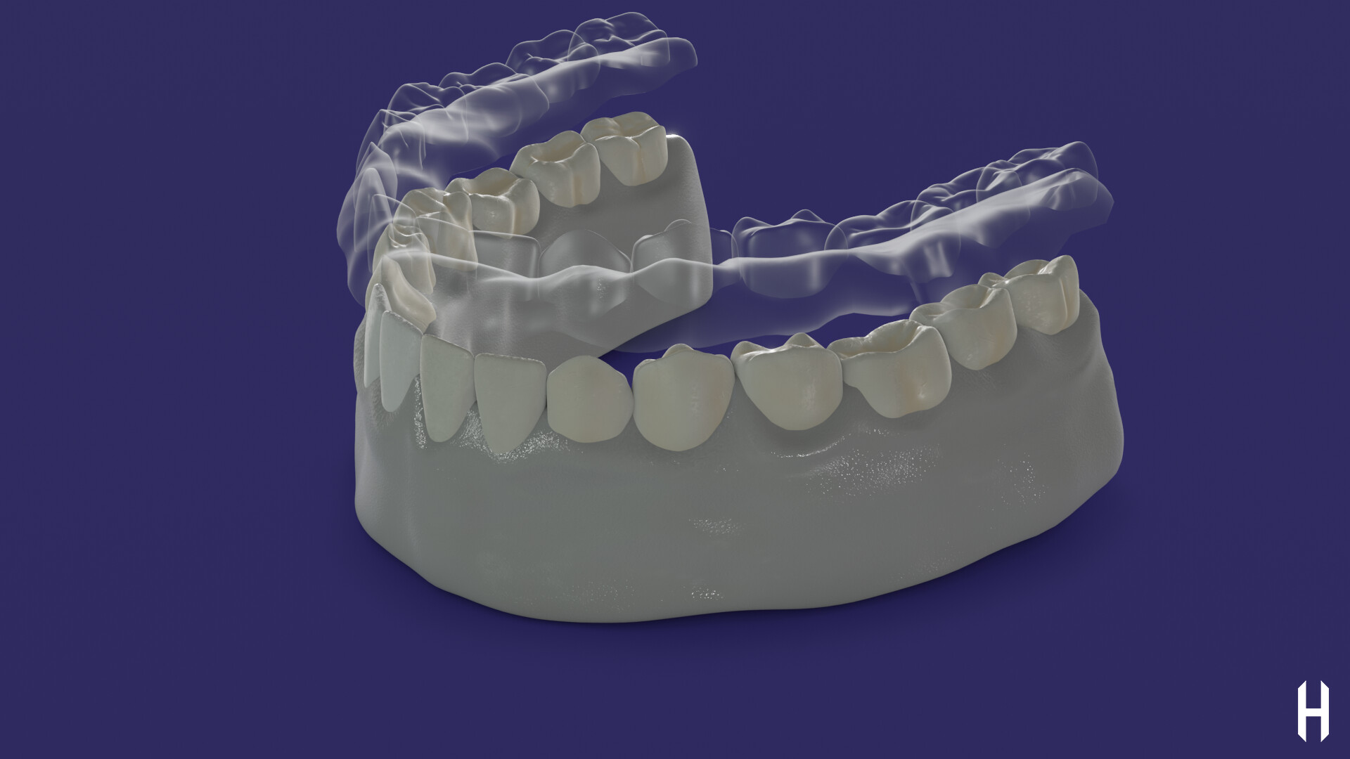 Hernán Bouchard - Teeth Animation