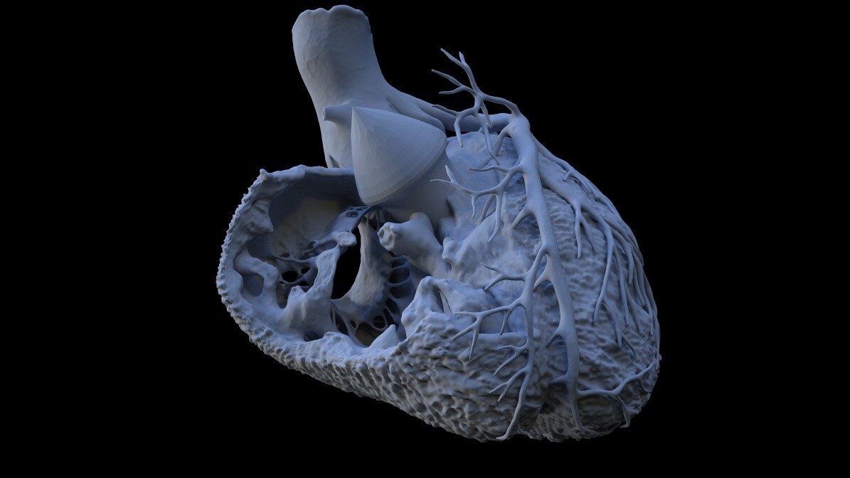 Bogdan Leahu - Injury Vector in STEMI