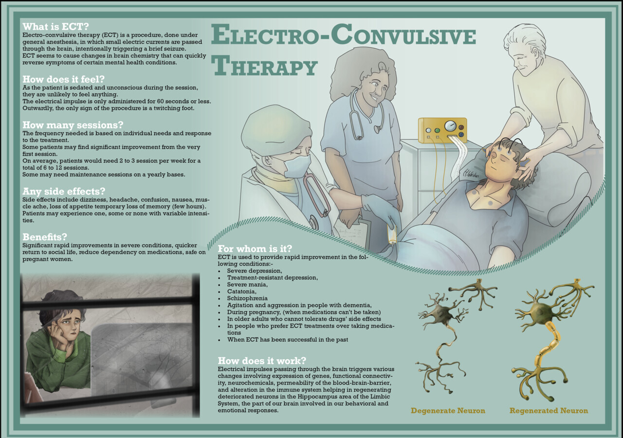 Electroconvulsive Therapy 2022