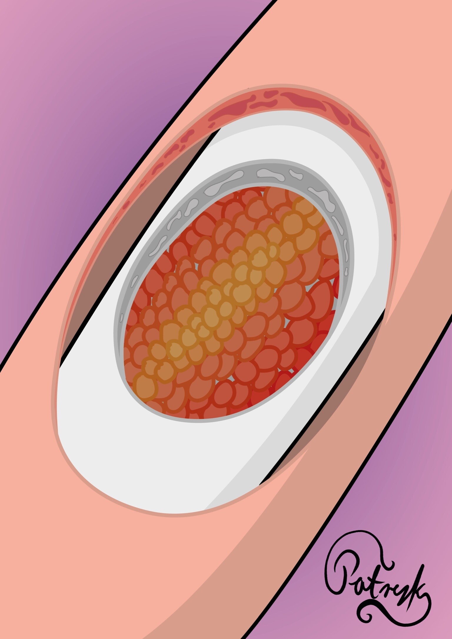 ArtStation - Marrow Art