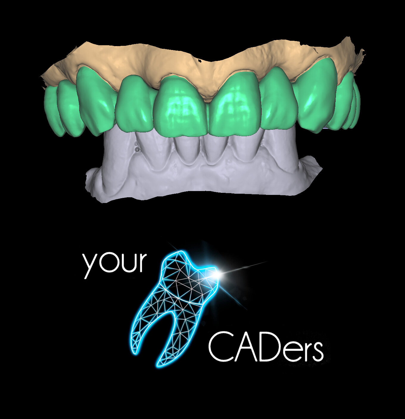 ArtStation - Exocad Dental Projects