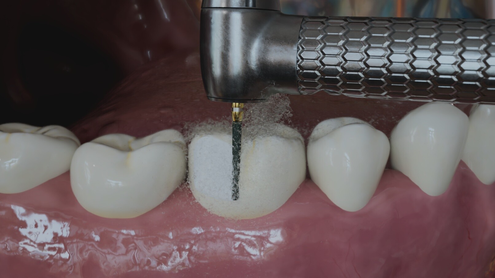 ArtStation - Dental Animation