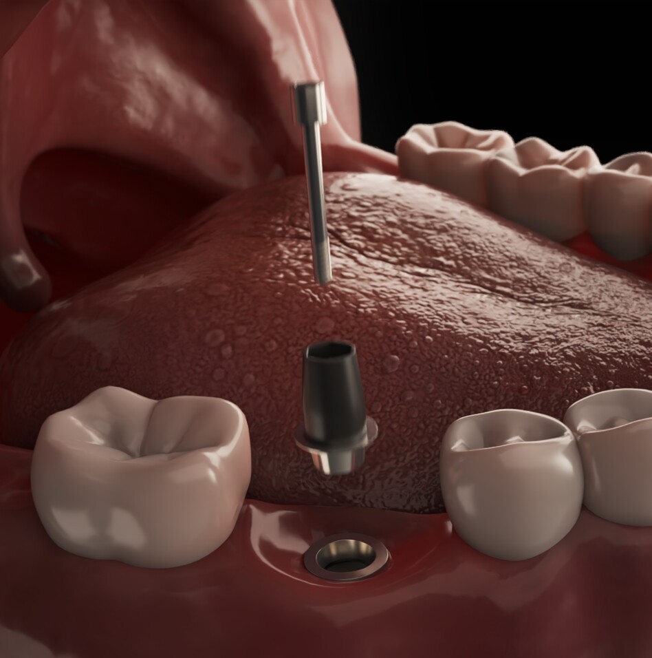 ArtStation - Dental Animation