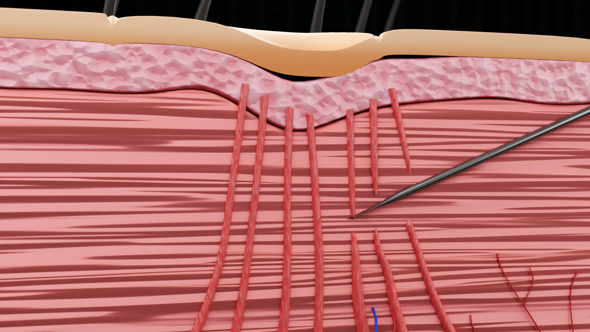 ArtStation - Subcision Method Animation