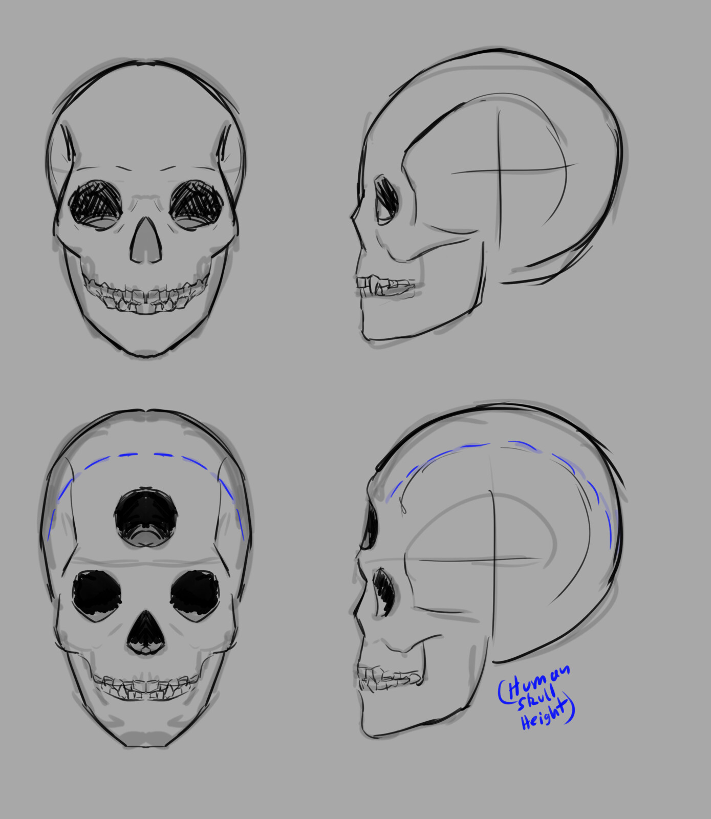 Kevin Altman - Imagining a "triclops" skull