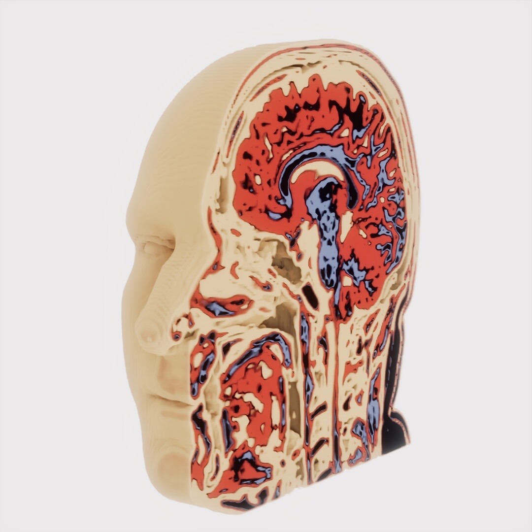 ArtStation - Brain MRI MedBlend Blender