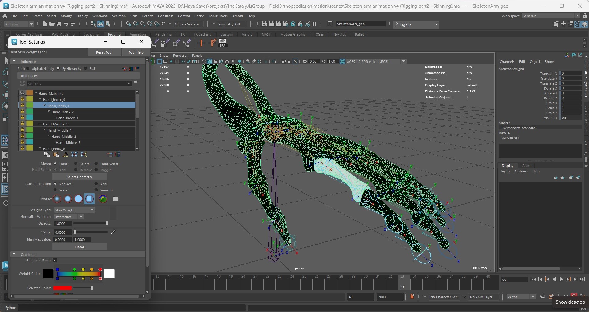 Miklos Lissa - Surgical Tools and Surgical Techniques on Skeleton Arm