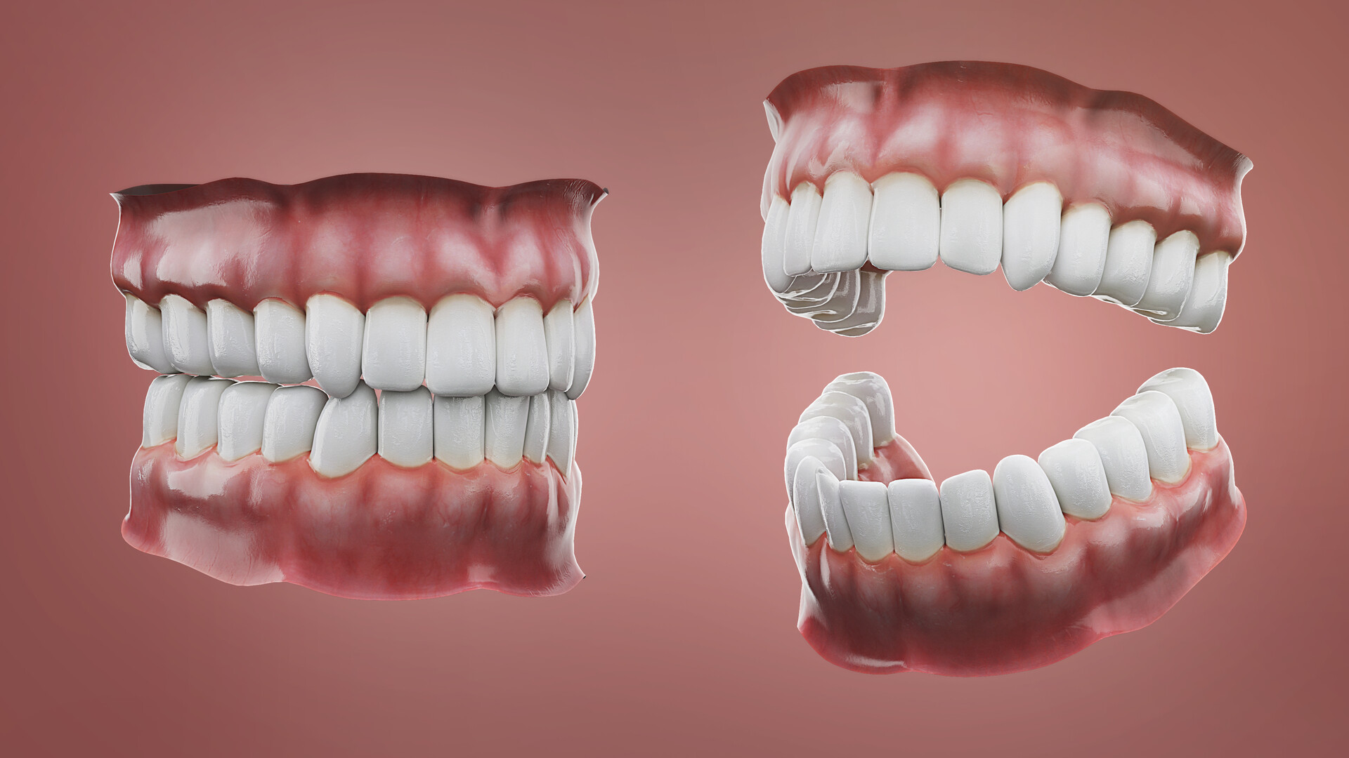 ArtStation - Dentures