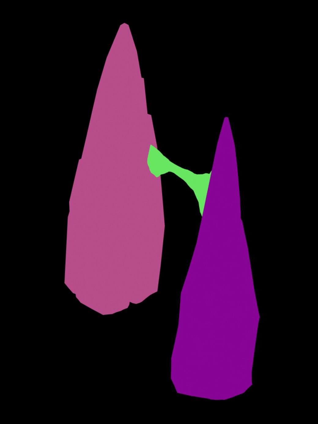 zhanfeng - Lava Hell - Stone Tooth 31