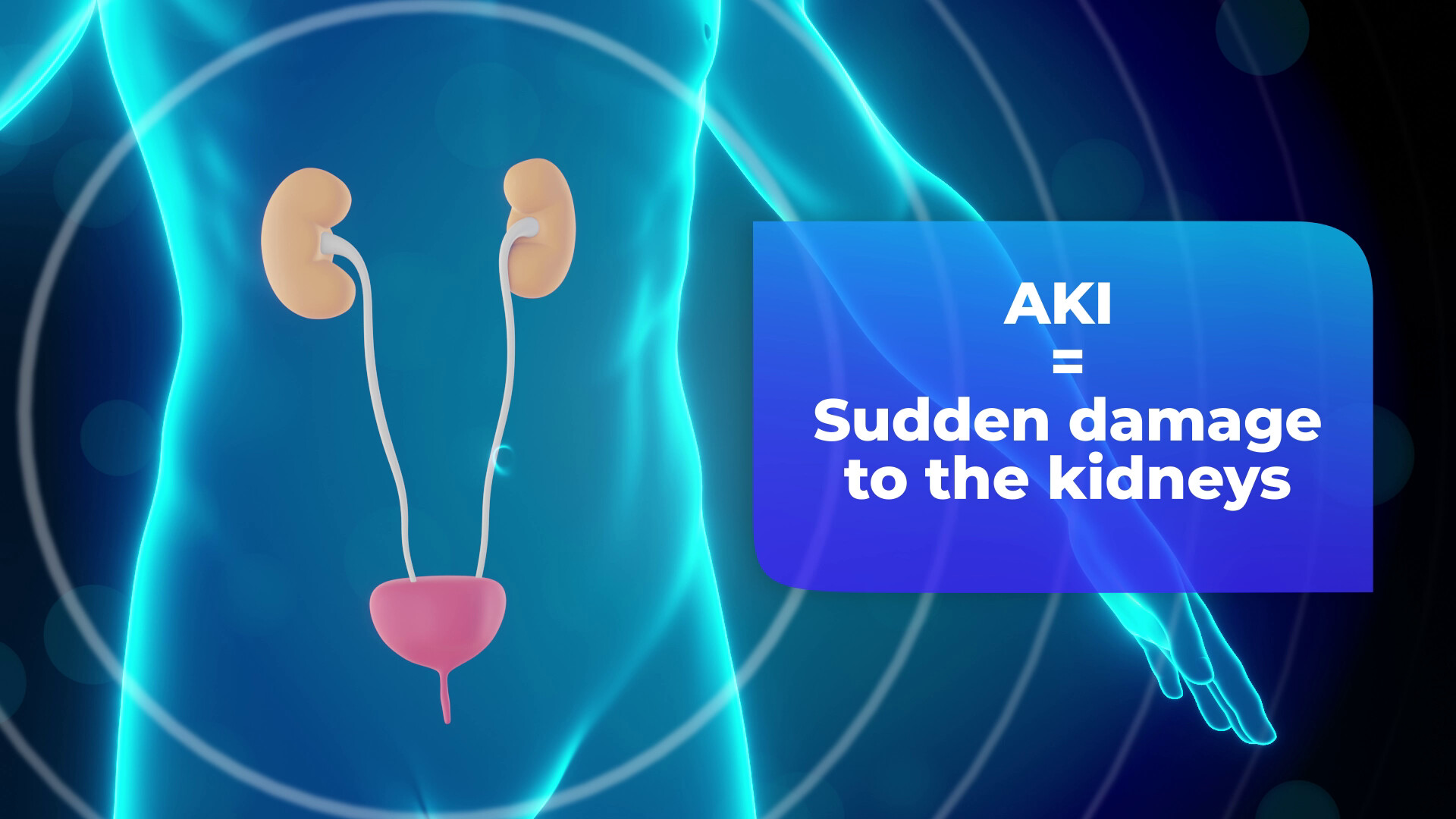 Andy Begg - CKD & AKI Medical Animation