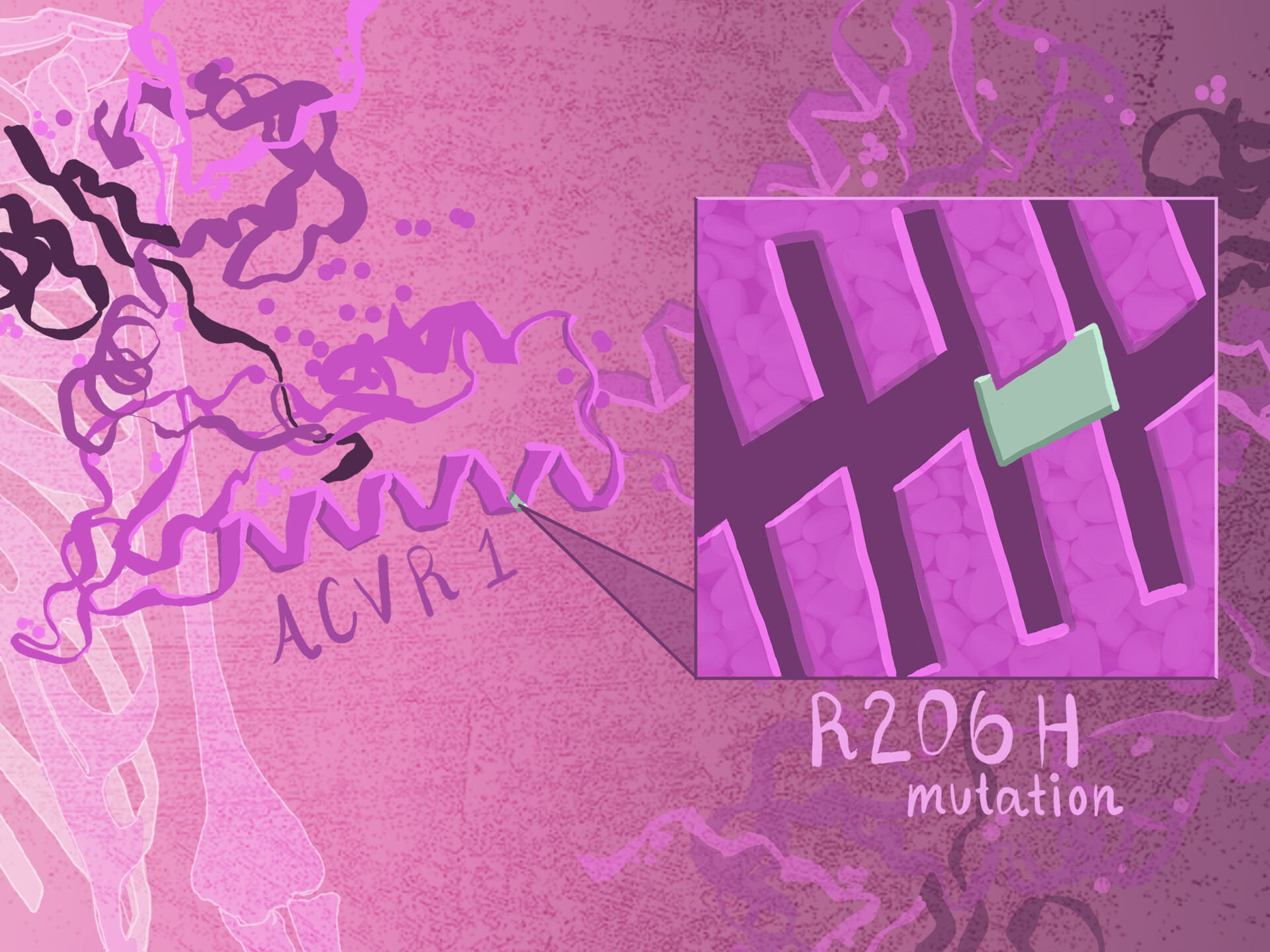 ArtStation - Fibrodysplasia Ossificans Progressiva Genetic Cause