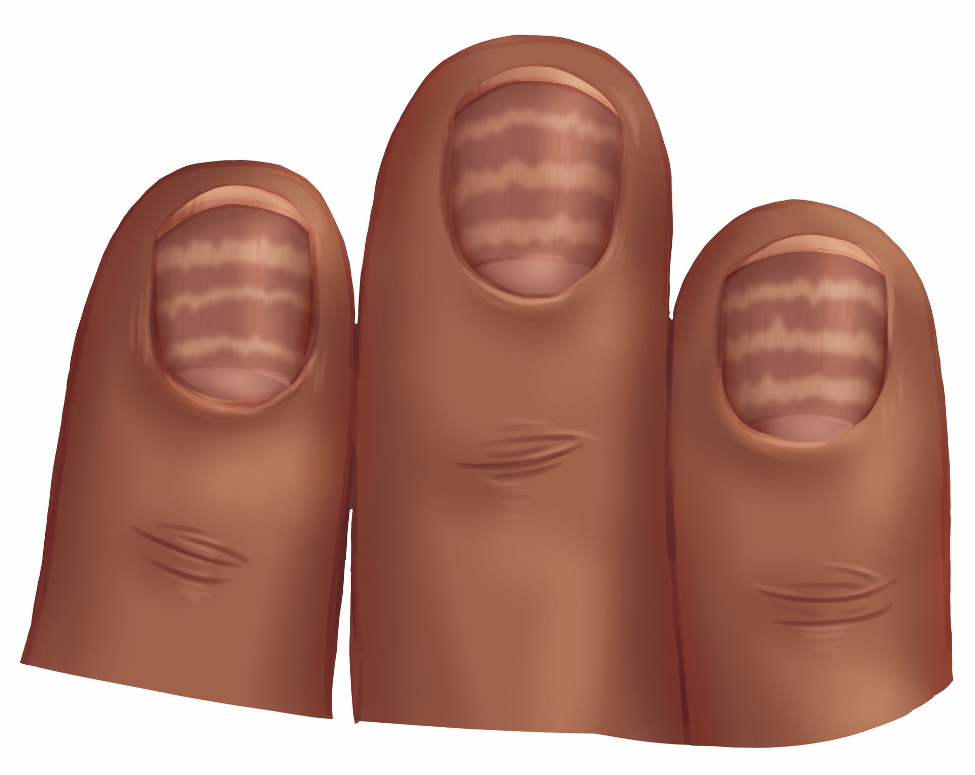 ArtStation - Paediatric Skin and Nail Conditions