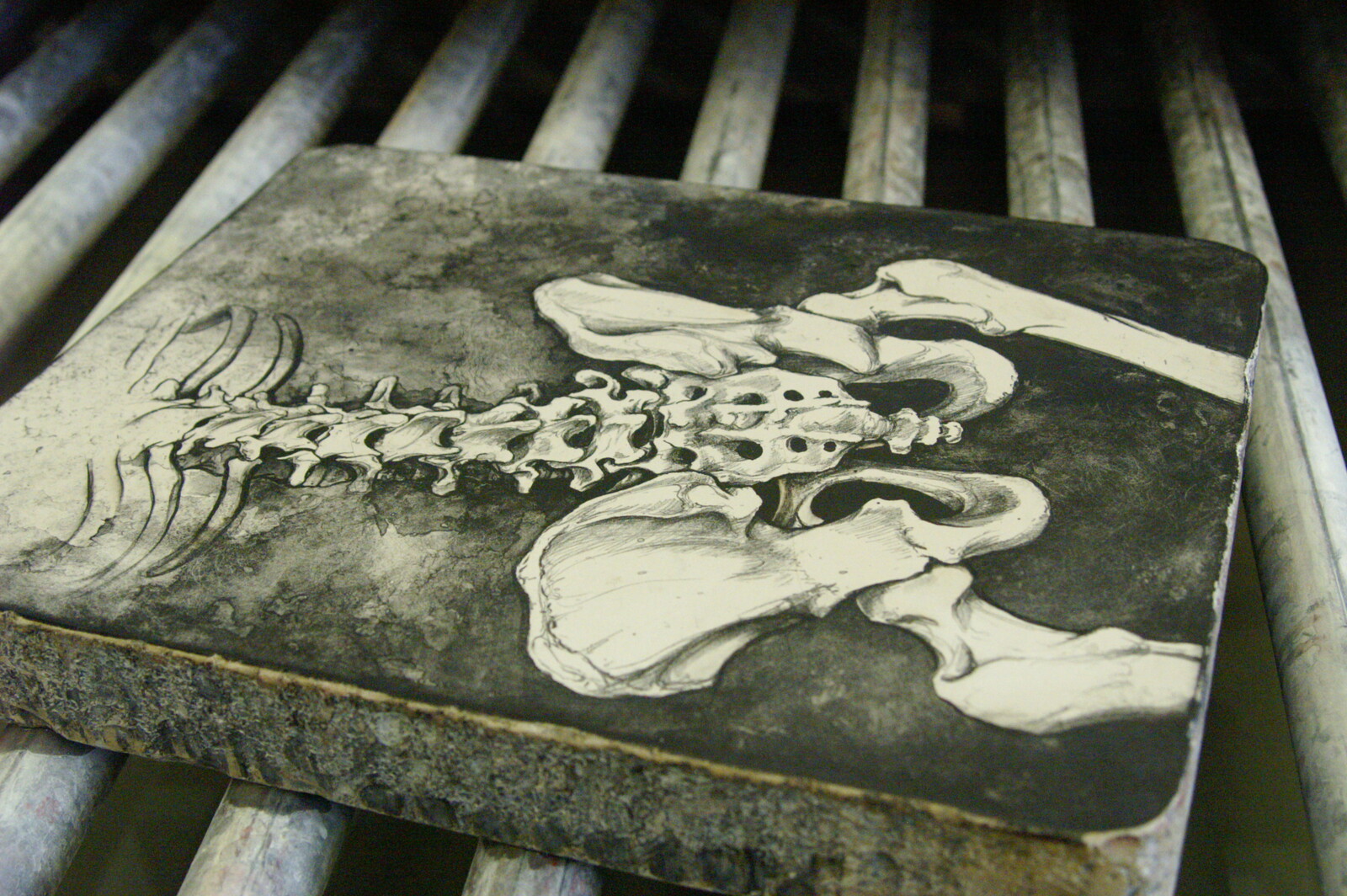 BD - Posterior Spine