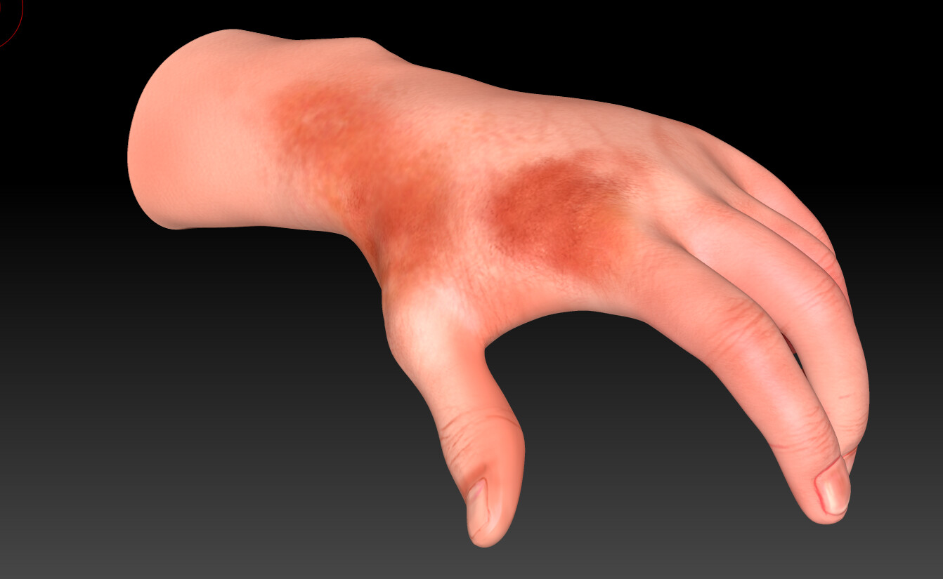 ArtStation - 3D Burned Hand