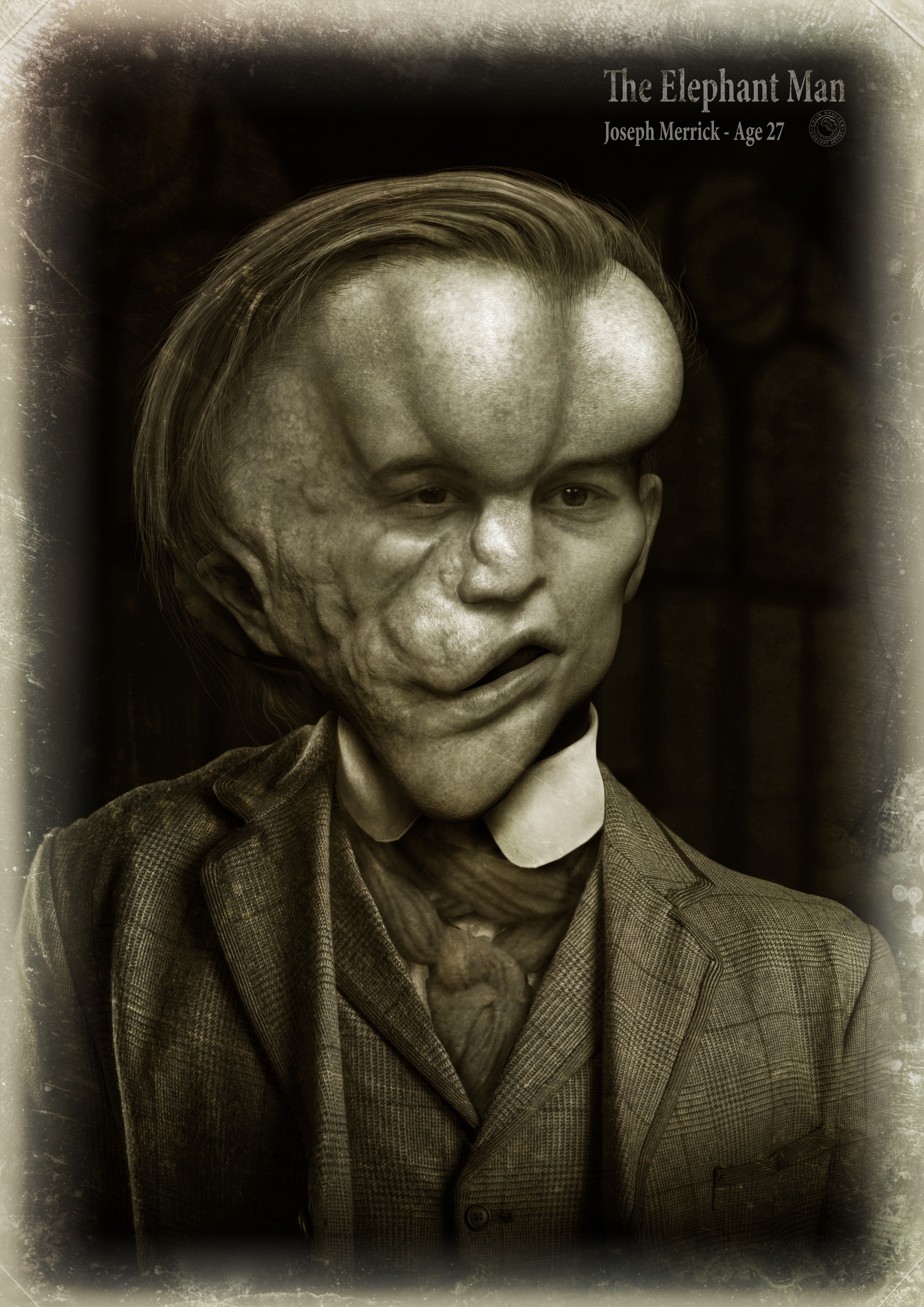 joseph merrick