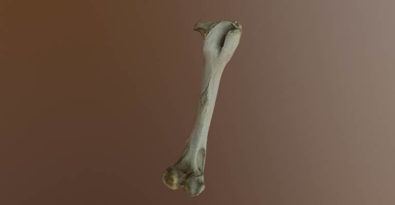 Stephen Jeal - Bone Scan