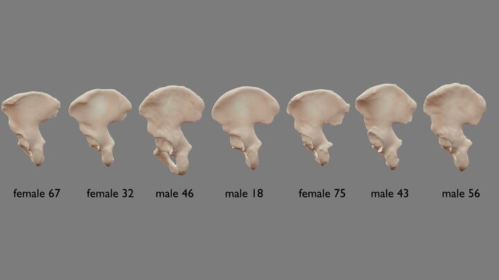ArtStation - Greater Sciatic Notch Variation